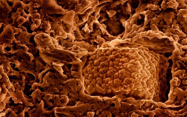 Foods Under The Microscope