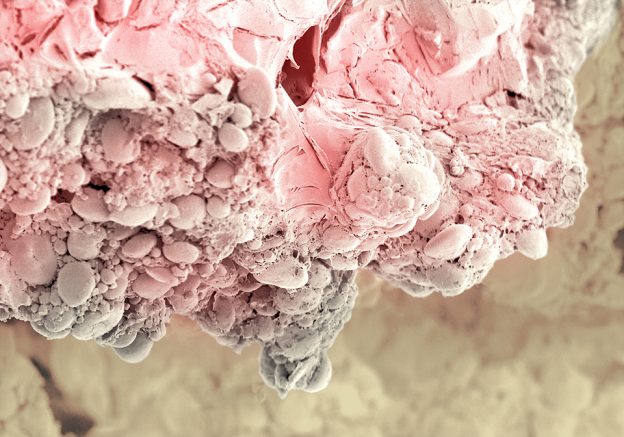 Foods Under The Microscope