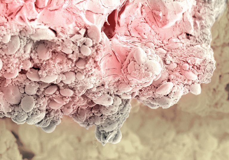 ≡ Foods Under The Microscope Brain Berries