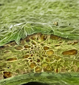 ≡ Foods Under The Microscope Brain Berries