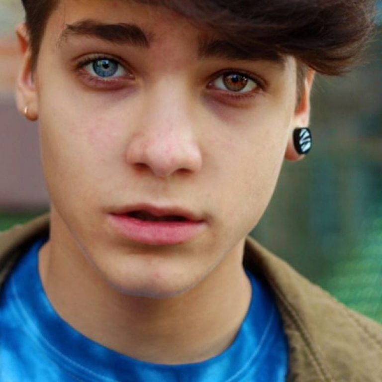 ≡ Beautiful Mutations: 15 Staggering Photos of Heterochromia Brain Berries