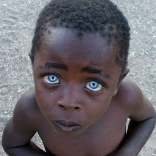 ≡ 10 Extremely Rare But Interesting Body Features Brain Berries