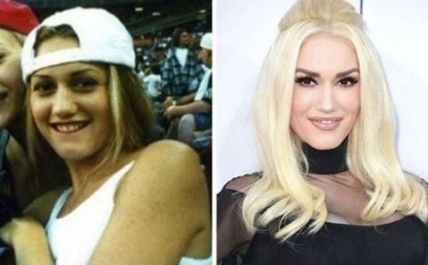 26 Rare Photos of Celebs Before They Were Famous