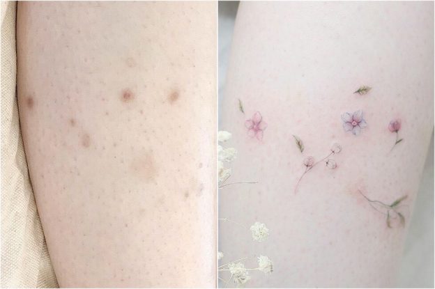 15 Creative Scar Tattoo Cover Ups