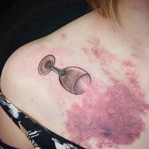 15 Creative Scar Tattoo Cover Ups