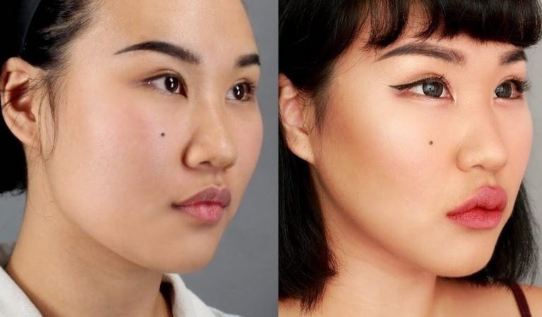 7 Popular Surgery Procedures In South Korea