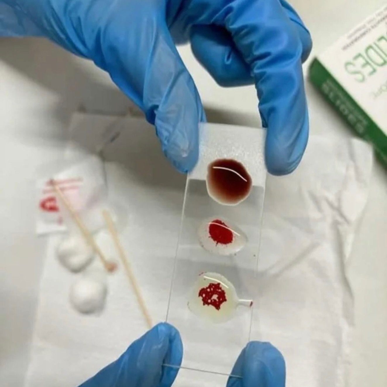 ≡ 10 Rarest Things Ever Discovered Brain Berries